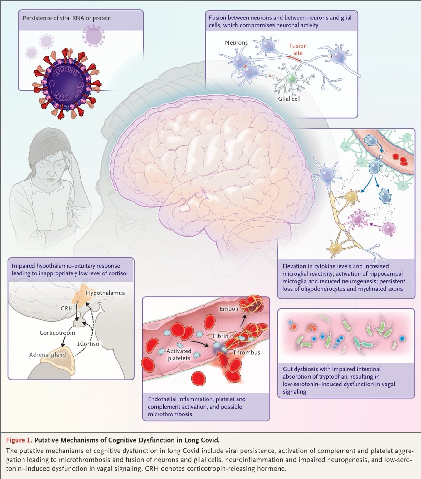 Gemeinschaftspraxis Dr. Rocke | Review: Pathophysiologie Post-COVID ...